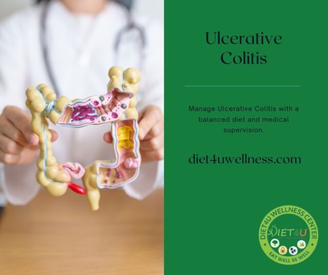 7 Day Meal Plan For Ulcerative Colitis | Diet4u Wellness